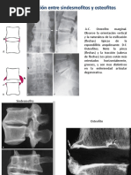 Osteofitos y Sindesmofitos