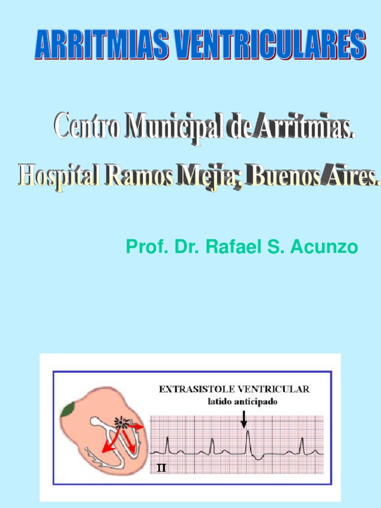 Arritmias Ventriculares 2017 | Arritmia cardiaca | Electrofisiologia