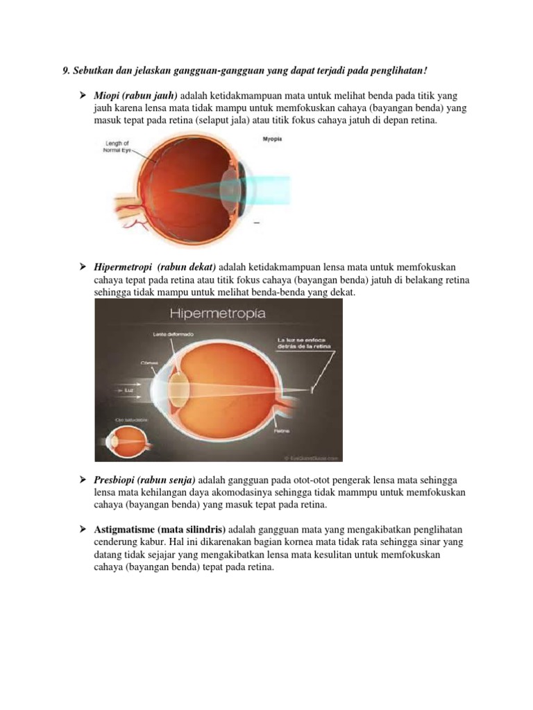 Jenis Gangguan Penglihatan | PDF