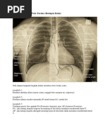 Anatomi Thorax Normal + Gambaran Radiologi | PDF