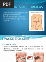 Incisión Rocky Davis | PDF | Medicina CLINICA | Anatomía