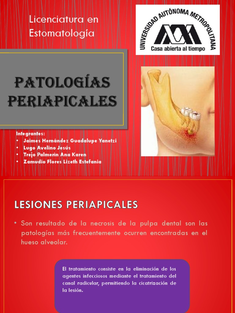 Patologias Periapicales | PDF | Inflamación | Ciencias de la Salud
