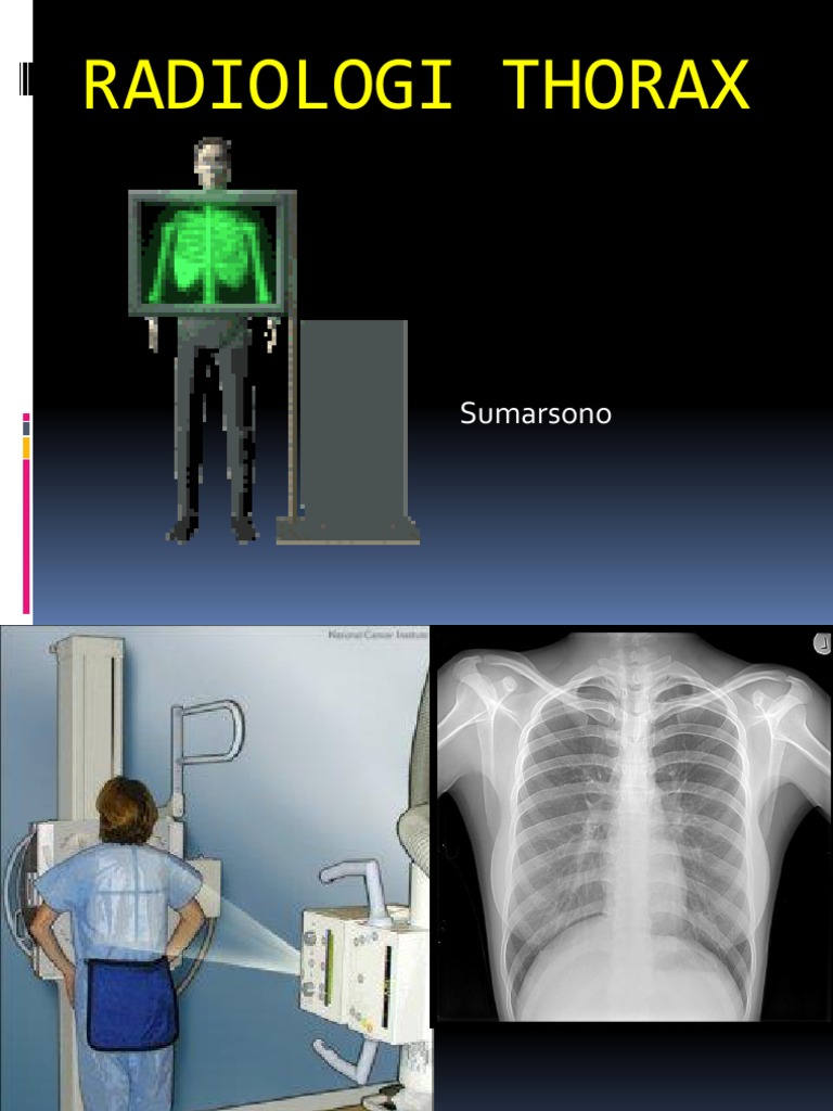 Thorax Radiology Guide | PDF | Aorta | Blood Vessel