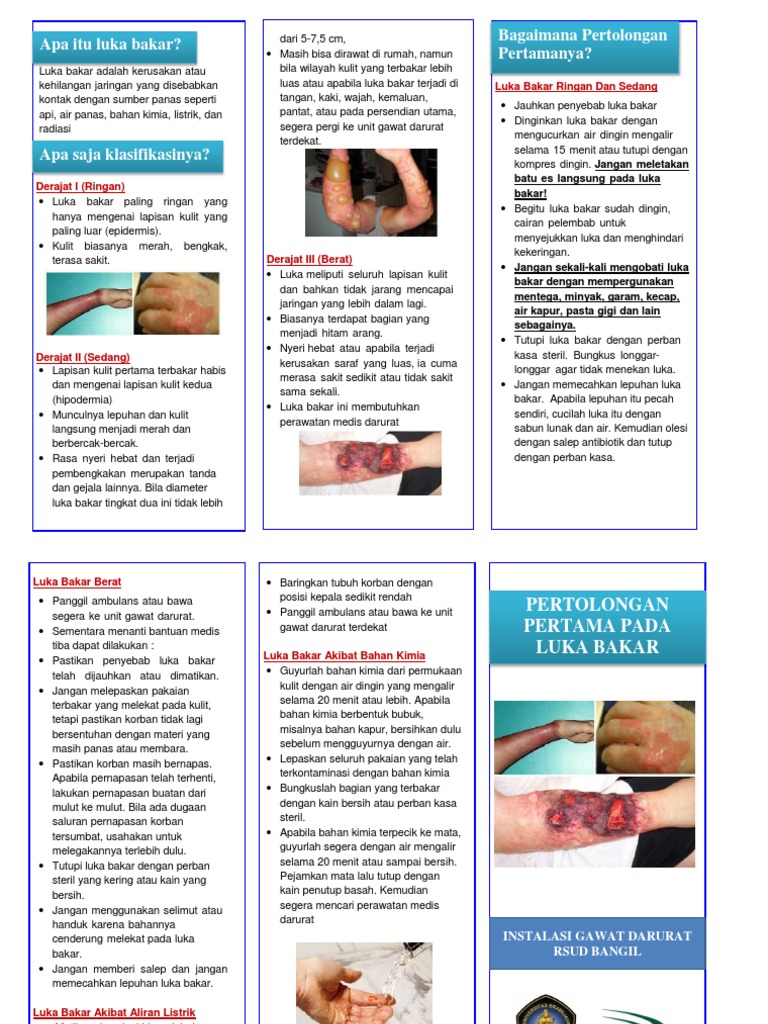 Leaflet Luka Bakar New Fix Sayang | PDF