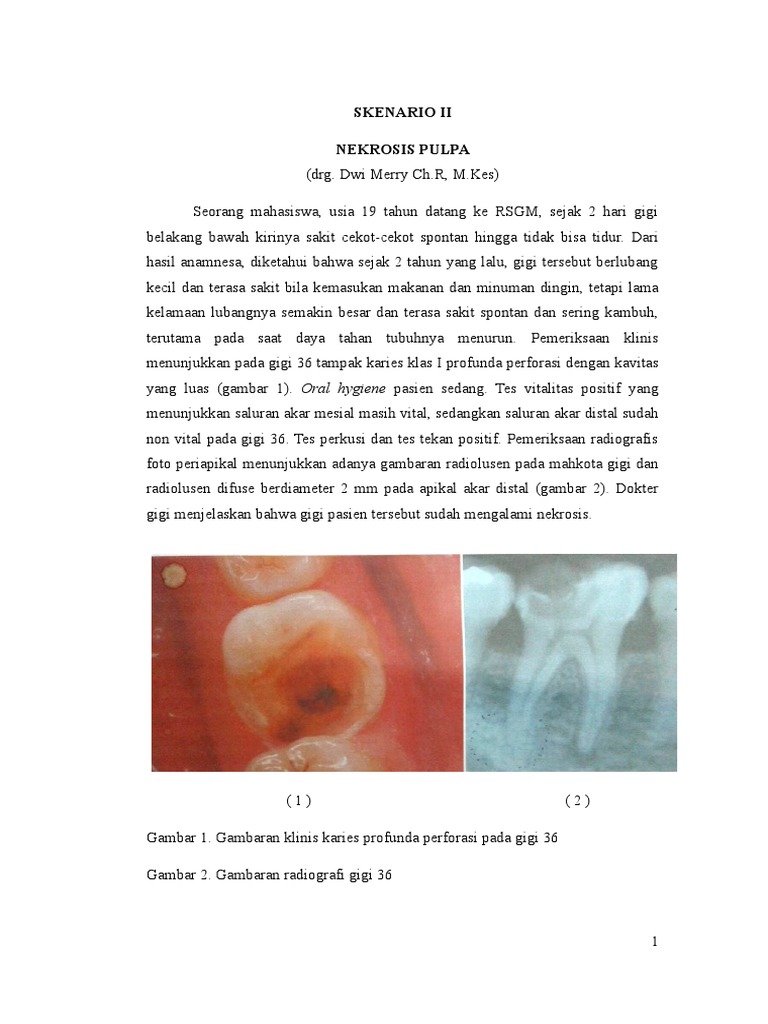 Laporan Tutorial Skenario 2 | PDF
