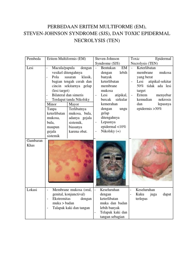 Perbedaan Eritem Multiforme | PDF