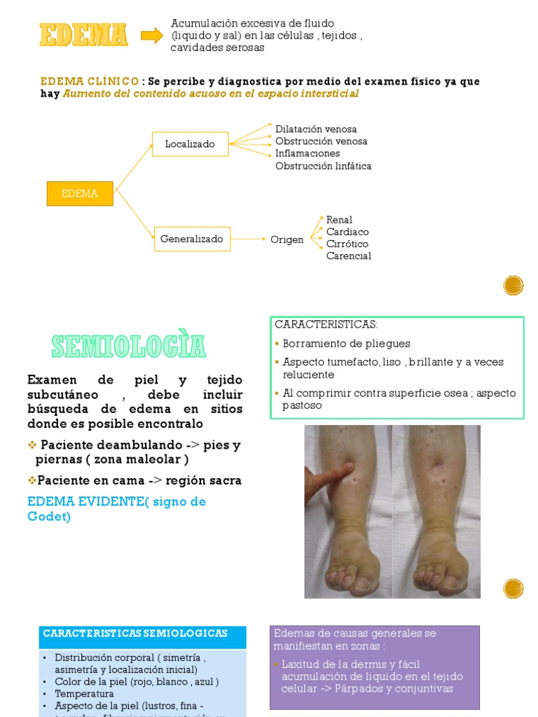 Edema | Edema | Especialidades Medicas