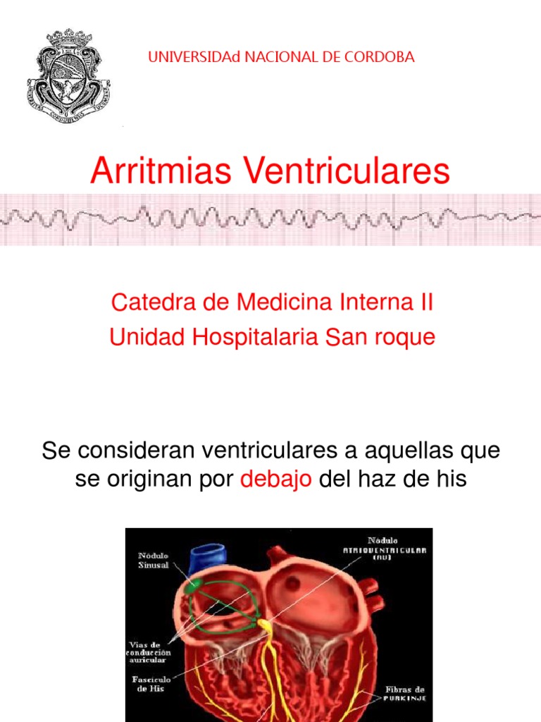 Arritmias Ventriculares | PDF | Electrocardiografia | Sistema ...