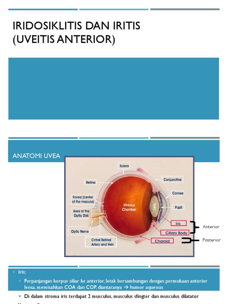 Iridosiklitis Dan Iritis | PDF