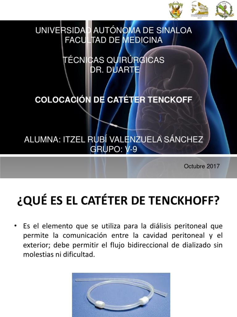 Catéter de Tenckhoff Usb | Diálisis | Peritoneo
