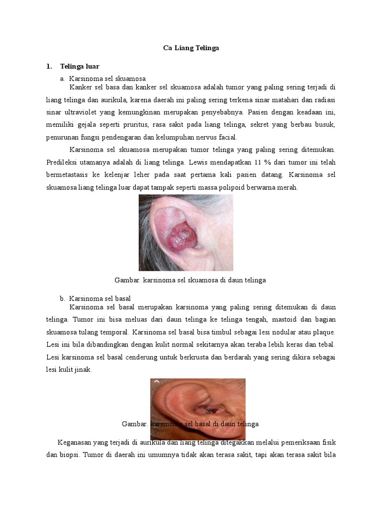 CA Liang Telinga | PDF