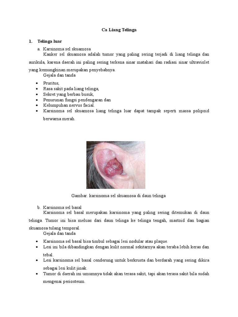 CA Liang Telinga New | PDF