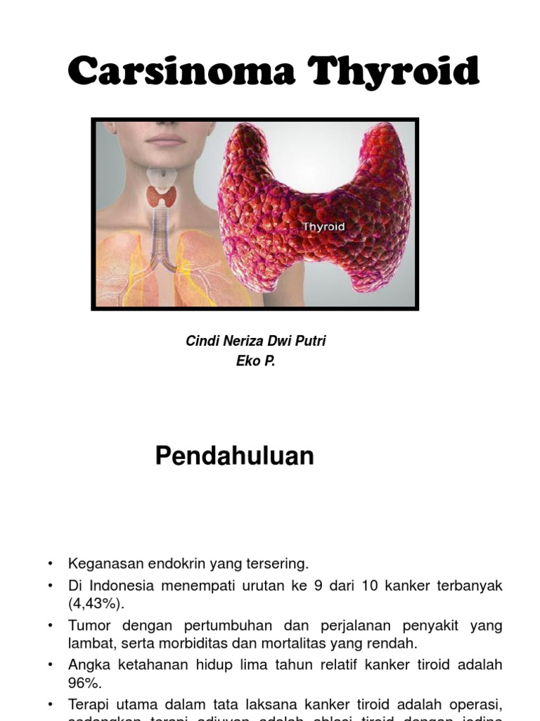 Karsinoma Tiroid: Diagnosis dan Terapi | PDF