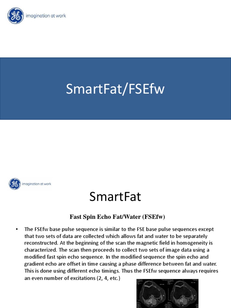 Smart Fat | PDF | Magnetic Resonance Imaging | Optics