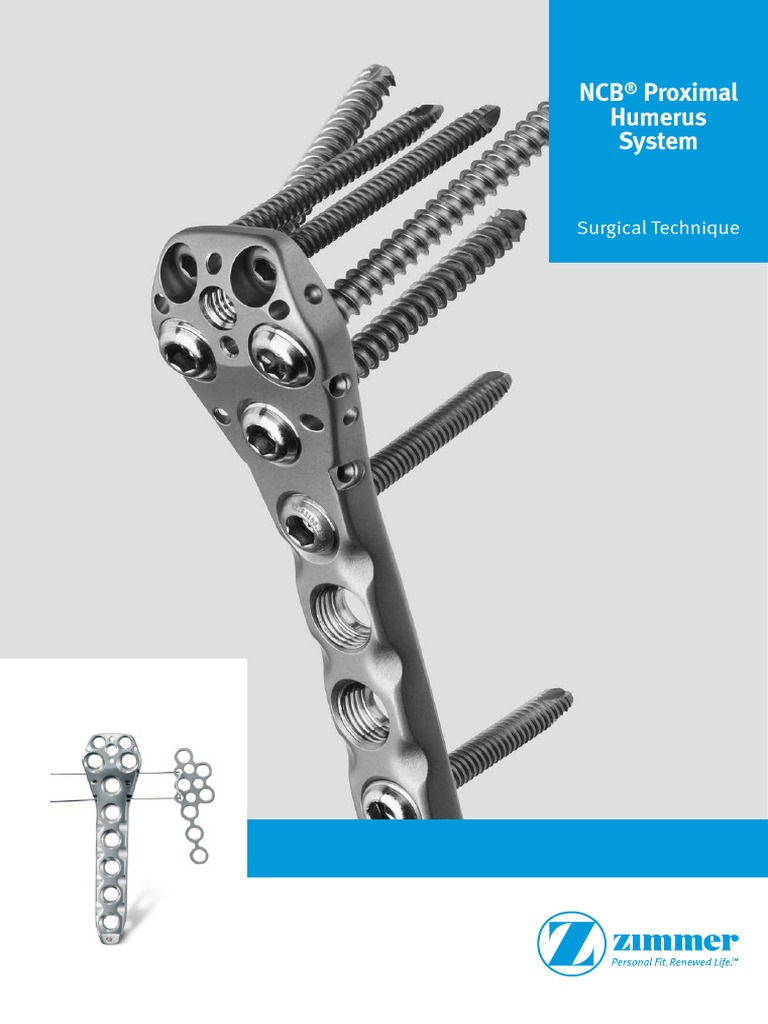 NCB Proximal Humerus System Surgical Technique | PDF | Screw | Dental ...