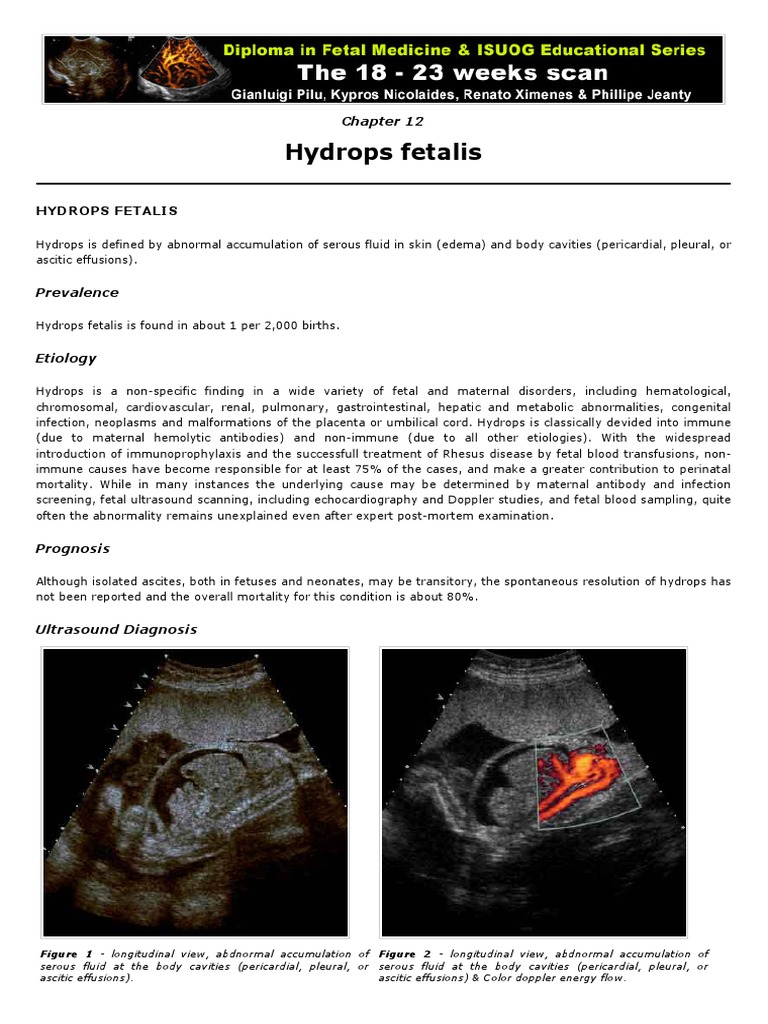 Hydrops Fetalis | PDF | Fetus | Anatomy