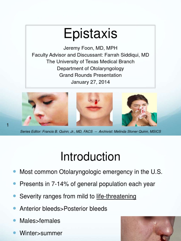 Epistaxis Pic 2014 01 G | PDF | Human Nose | Human Anatomy