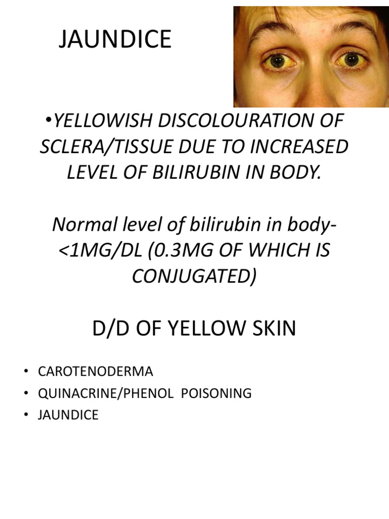 Jaundice: - Yellowish Discolouration of | PDF | Digestive System ...