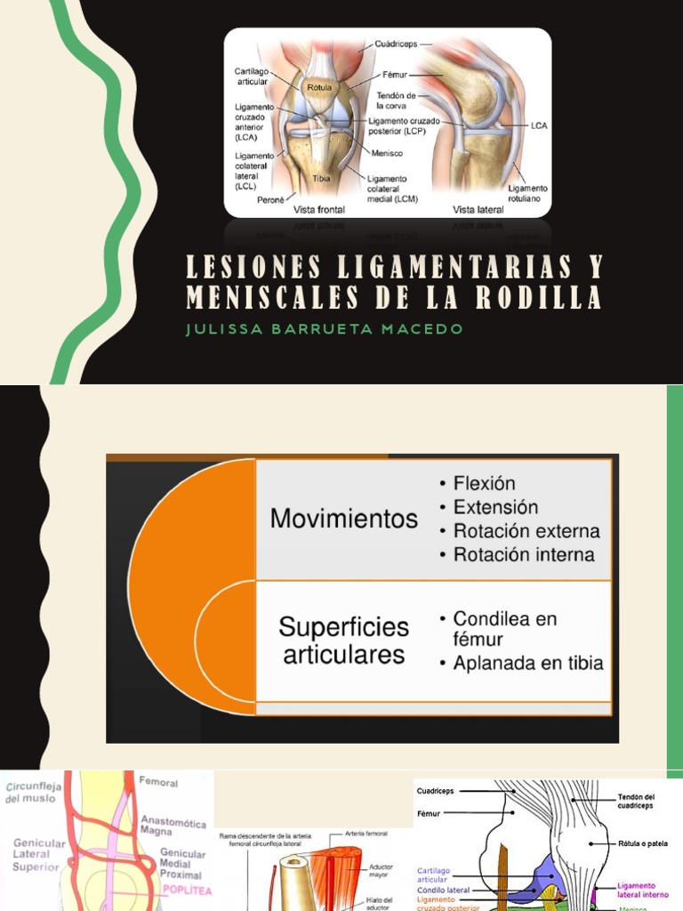 Lesiones Ligamentarias y Meniscales de La Rodilla | PDF ...