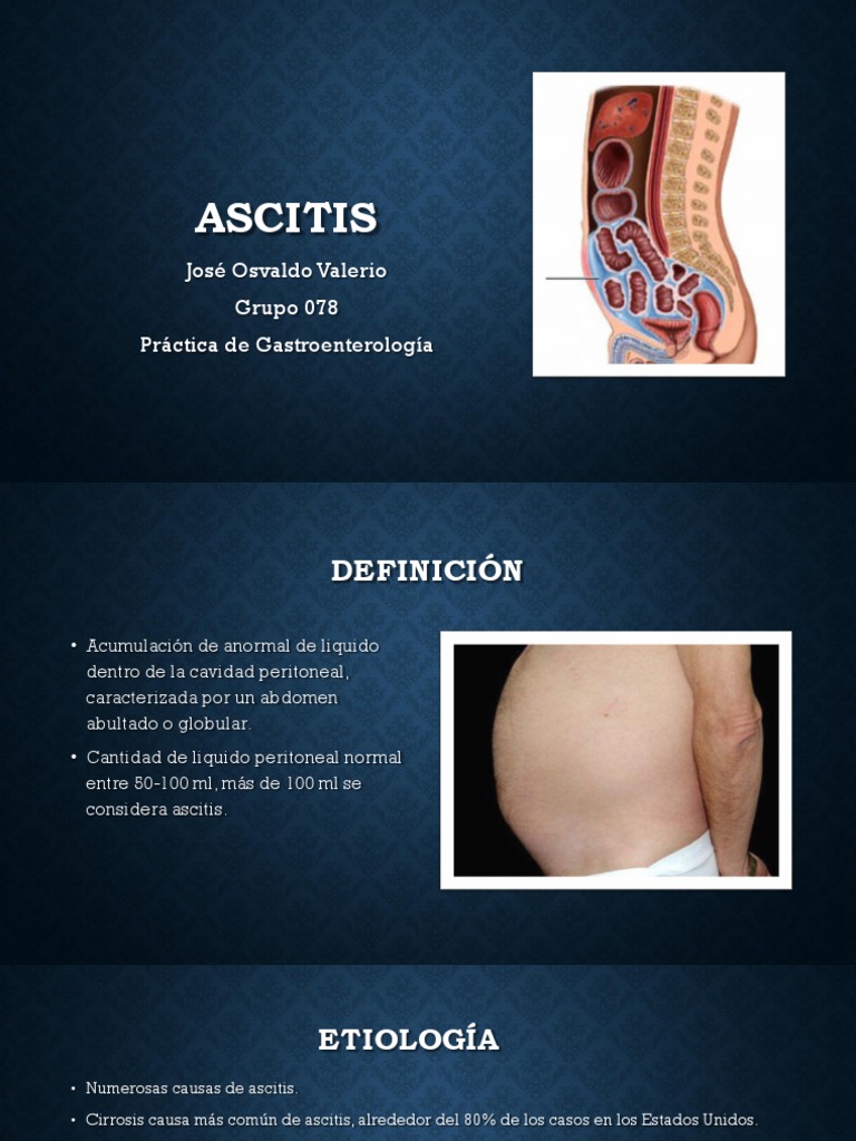 Causas y Clasificación de Ascitis | PDF | Medicina CLINICA ...