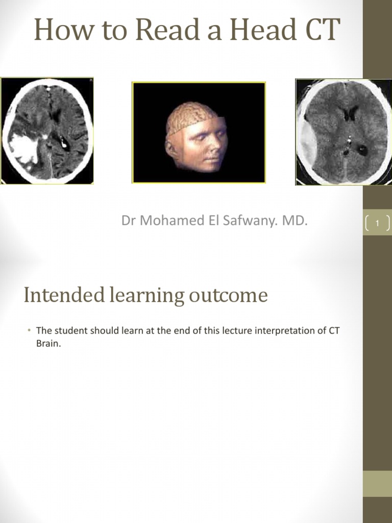 4-How To Read A Head CT | PDF | Diseases And Disorders | Nervous System