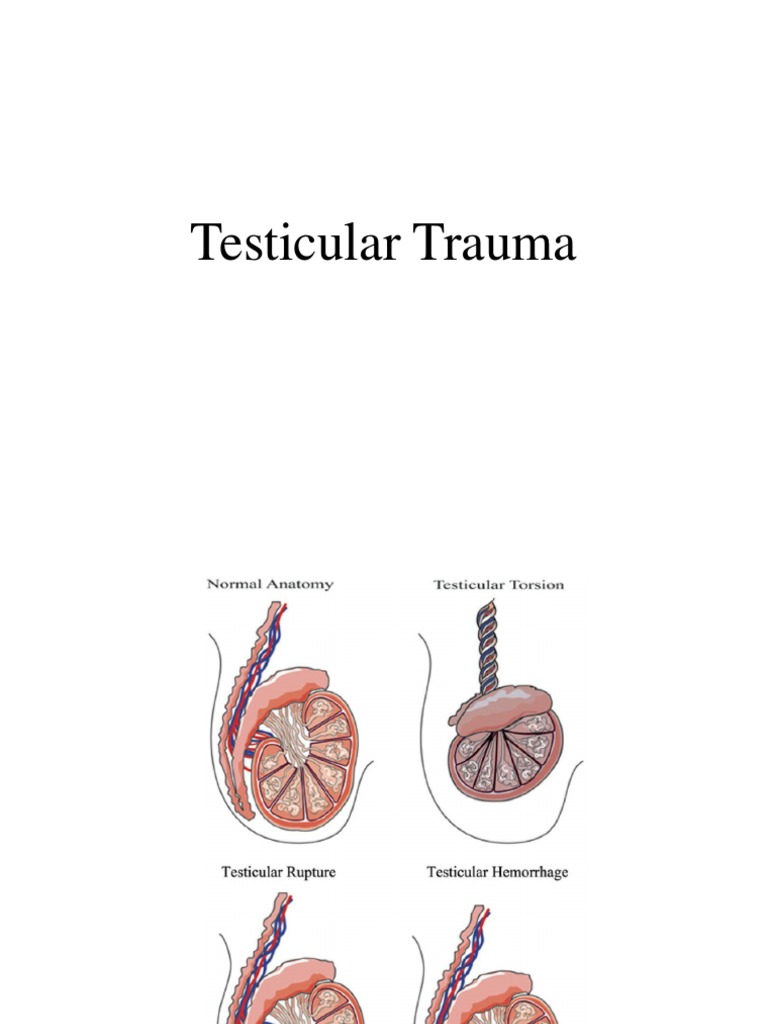Testicular Trauma | PDF