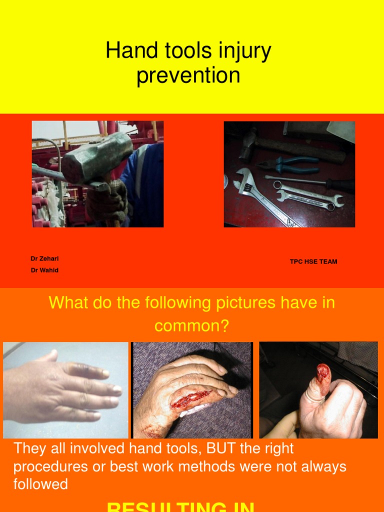 Hand Tools Injury Prevention: DR Zehari DR Wahid TPC Hse Team | PDF ...