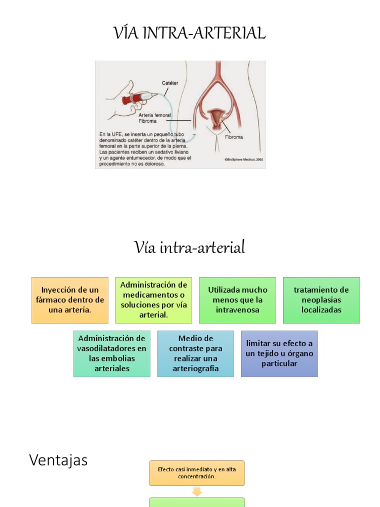 Vía Intra Arterial | PDF