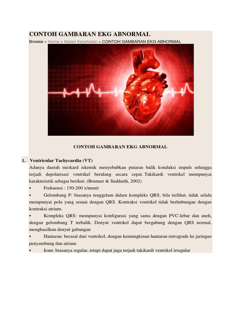 Contoh Gambaran Ekg Abnormal | PDF