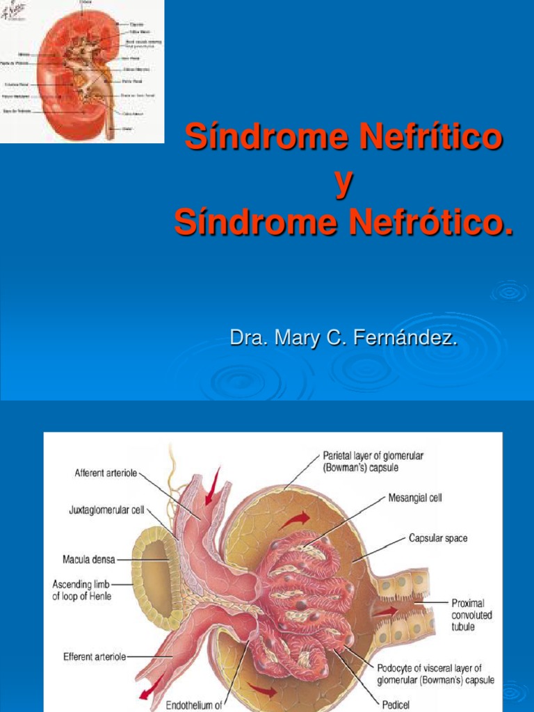 Sx Nefri- Nefro. Clase | Genitourinary System Diseases | Internal Medicine