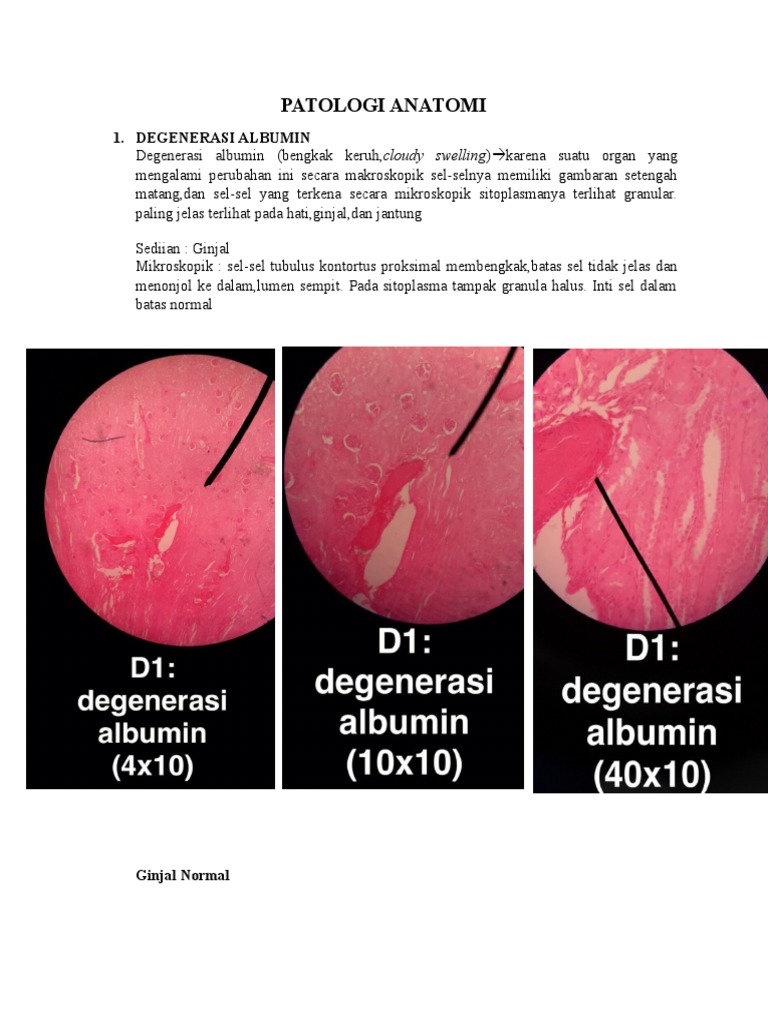 Patologi Anatomi | PDF
