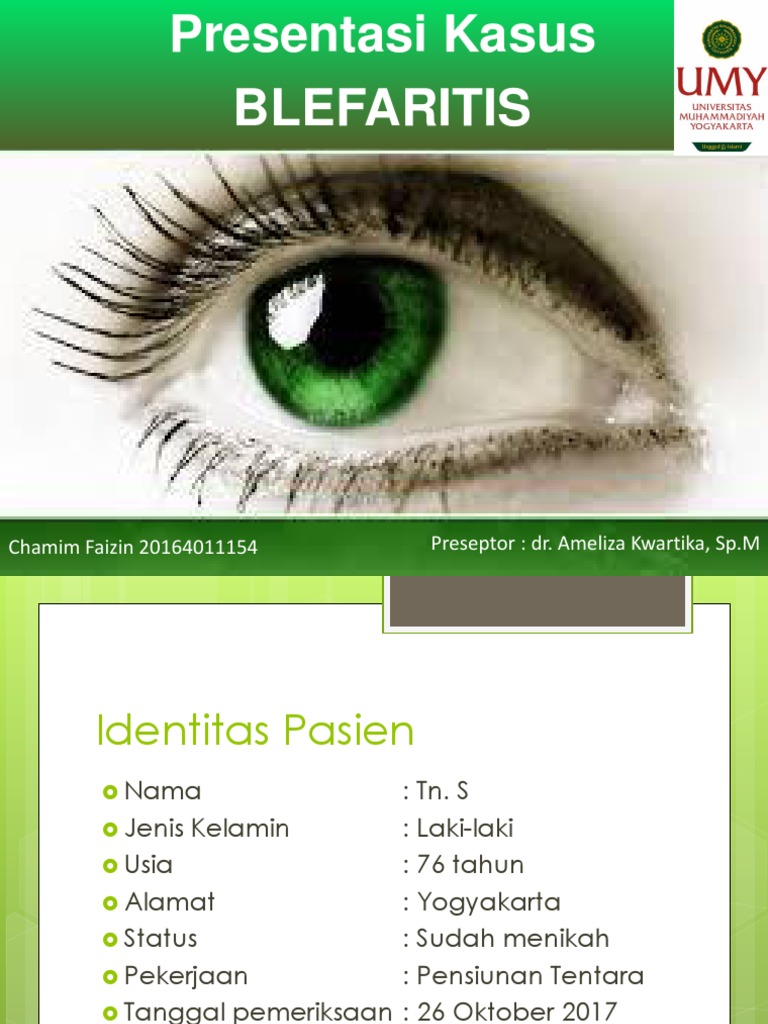 Blefaritis Seboroik dan Corpus Alienum Konjungtiva | PDF