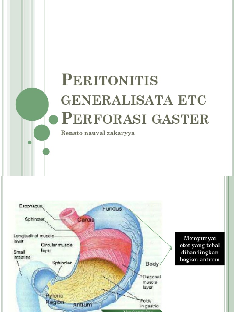 Perforasi Gaster | PDF