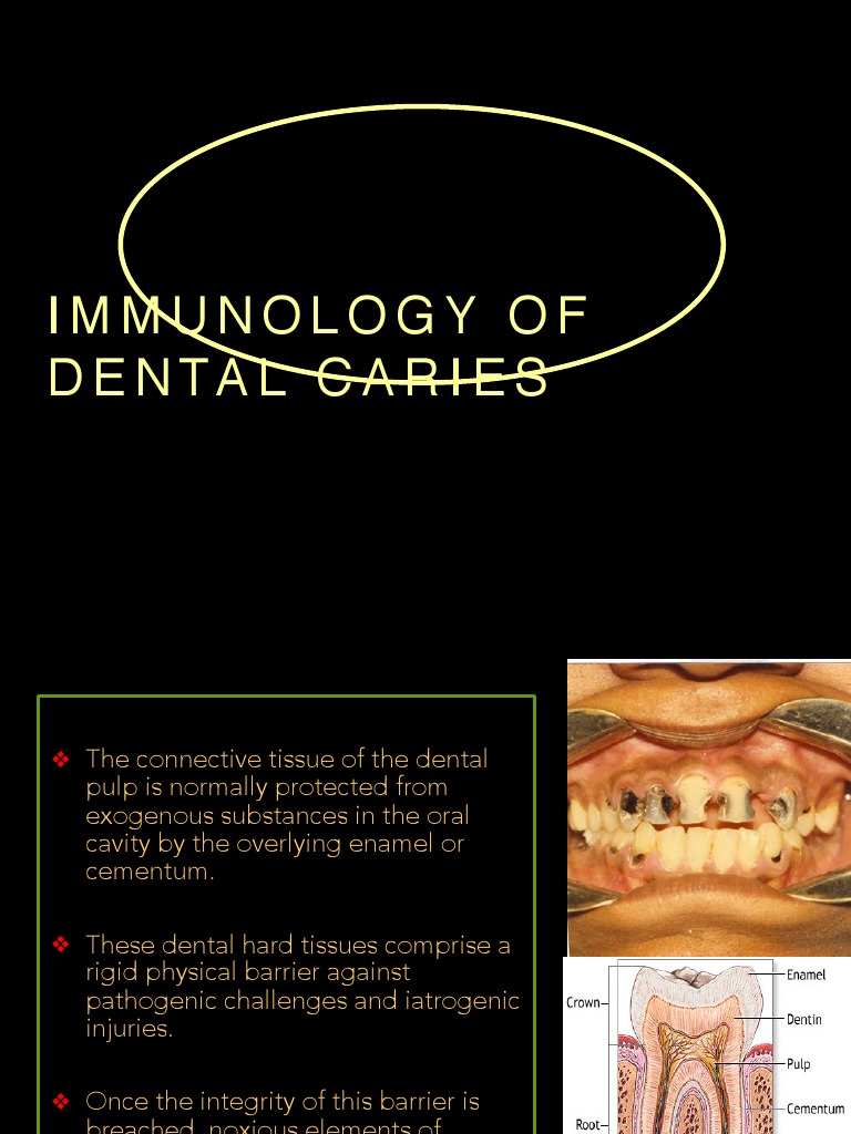 Immunology Dental Caries | PDF | Inflammation | Immune System