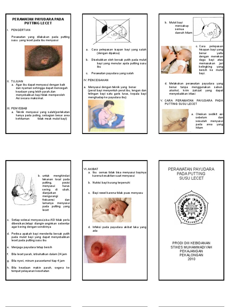 Breascare Puting Lecet | PDF
