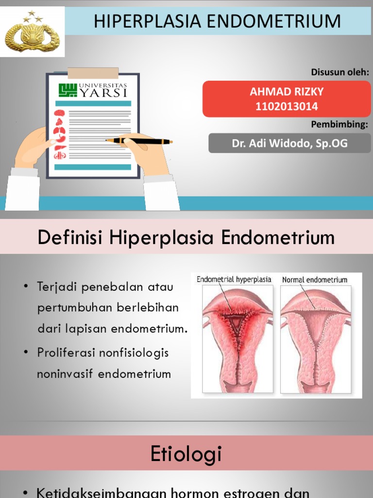 Hiperplasia Endometrium: Definisi dan Terapi | PDF