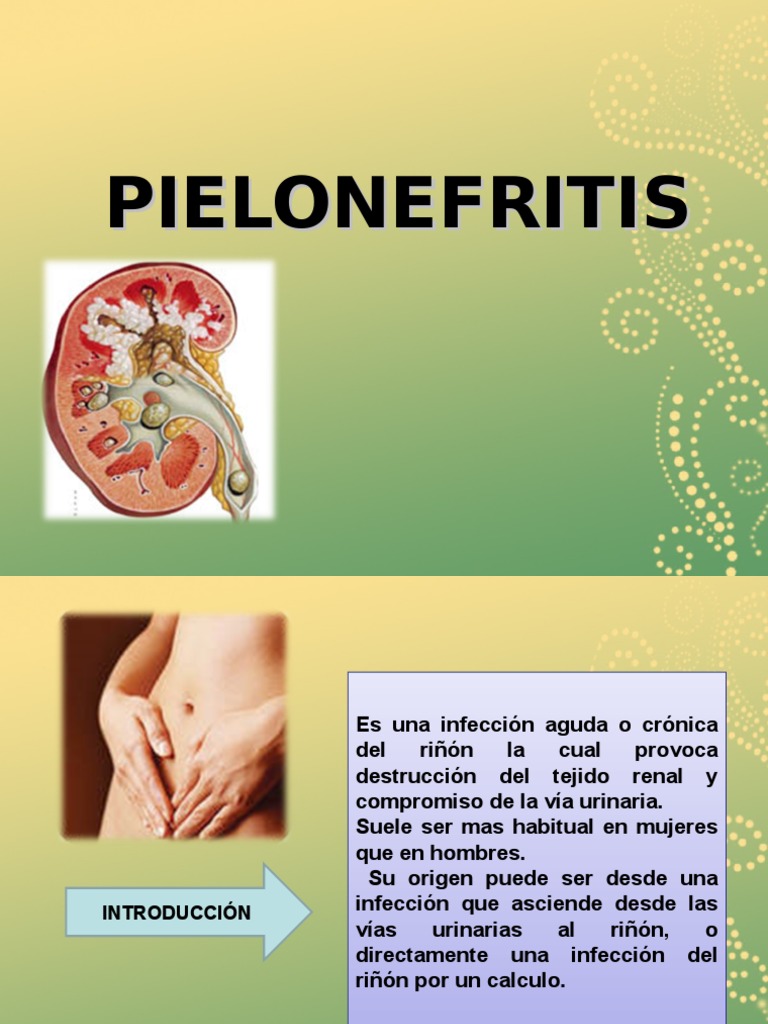 Pielonefritis: Causas y Tratamiento | PDF | Órgano (anatomía) | Sistema ...