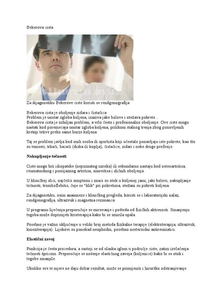 Bekerova Cista | PDF