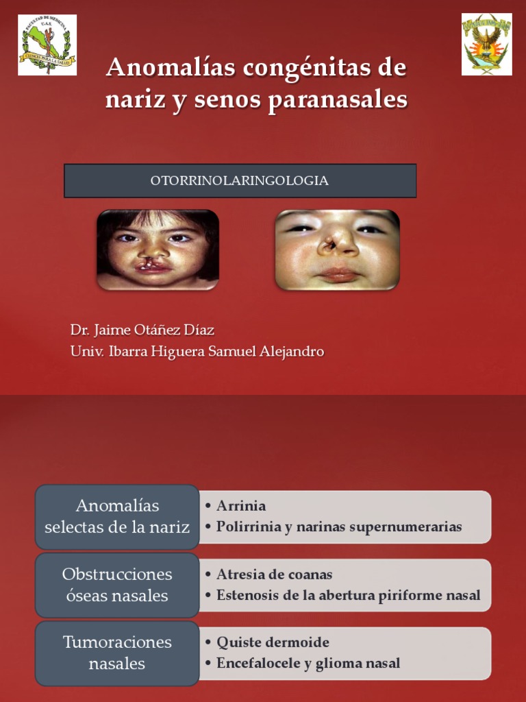 Anomalías Congénitas Nasales | PDF | Anatomía humana | Especialidades ...