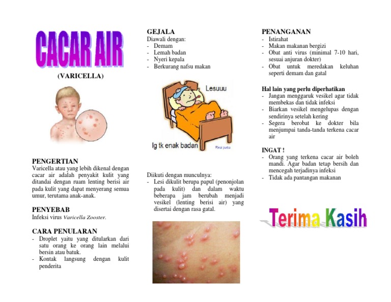 Leaflet Cacar Air | PDF