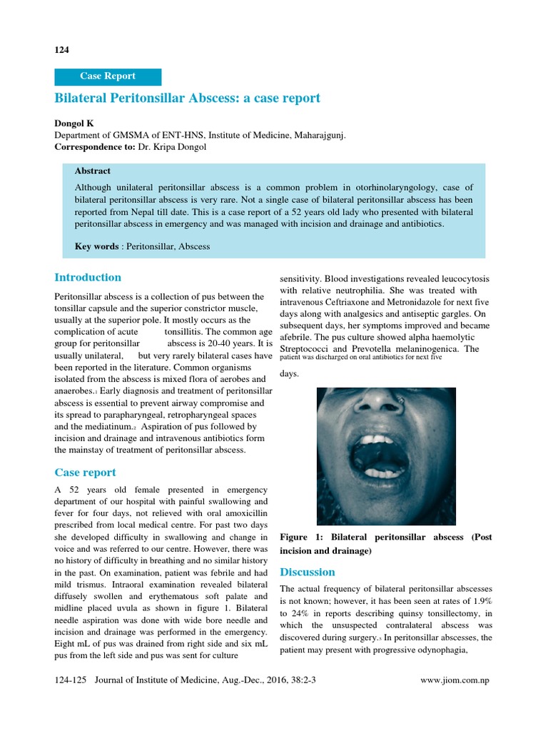 Bilateral Peritonsillar Abscess: A Case Report | PDF | Rtt | Medical ...