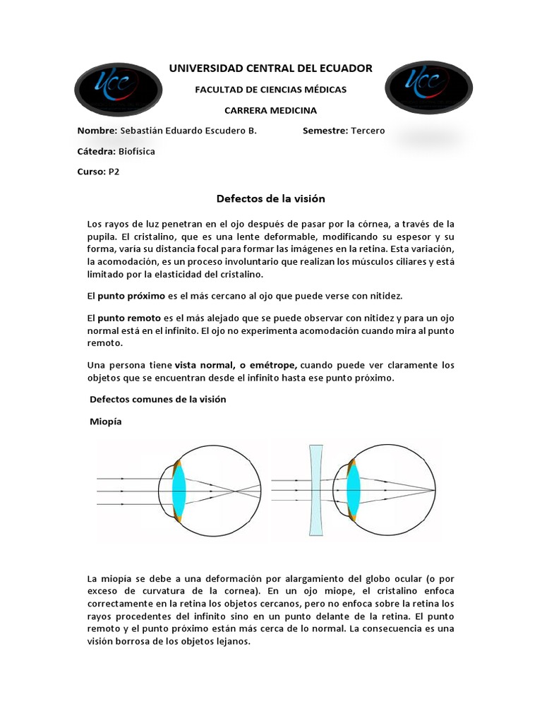 Defectos de La Vision | PDF | Ojo humano | Percepción visual
