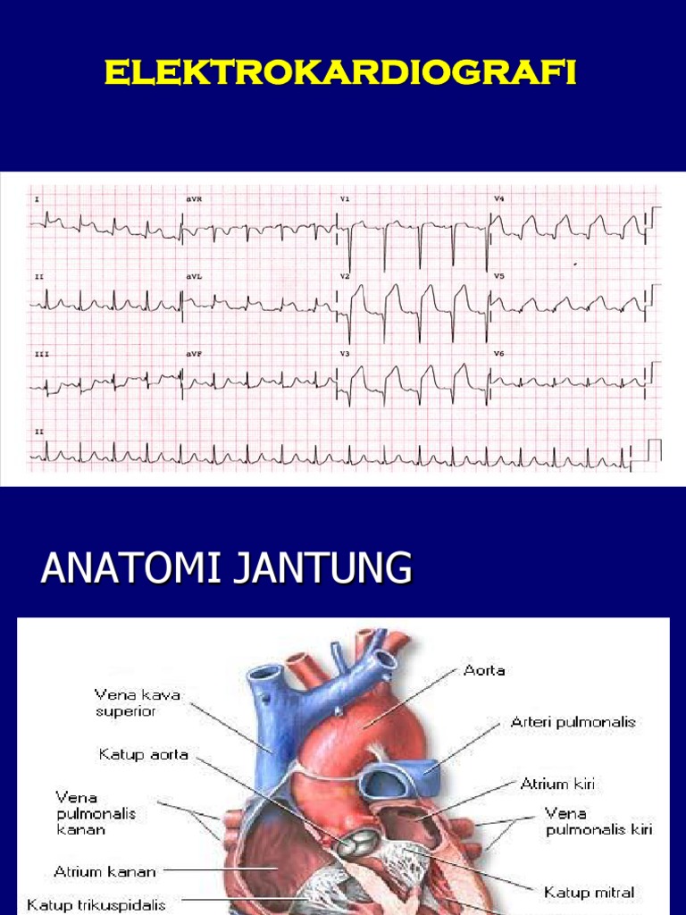 Ekg | PDF | Elektrokardiografi | Fisiologi Kardiovaskular
