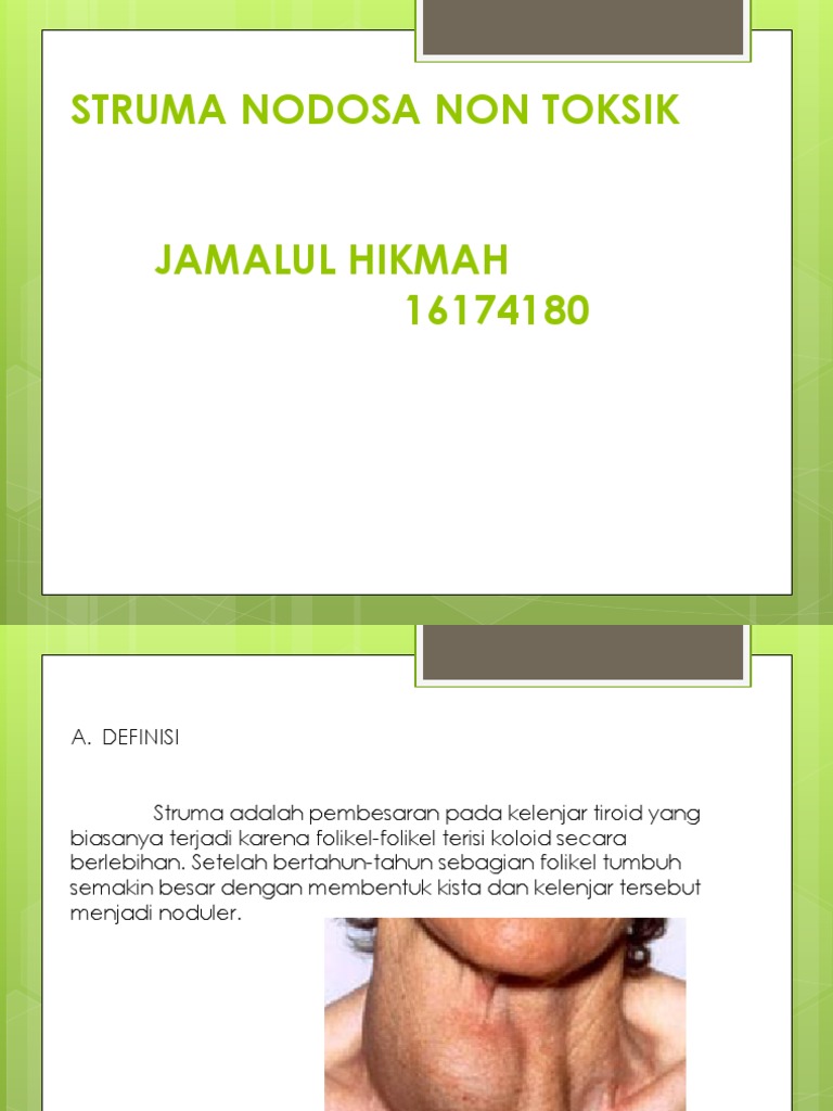 Struma Nodosa Non Toksik | PDF