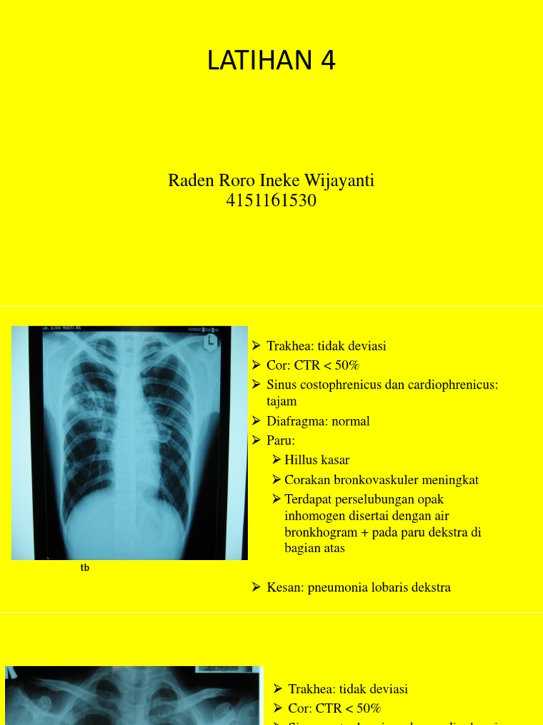 Evaluasi Sinus Costophrenicus dan Cardiophrenicus | PDF