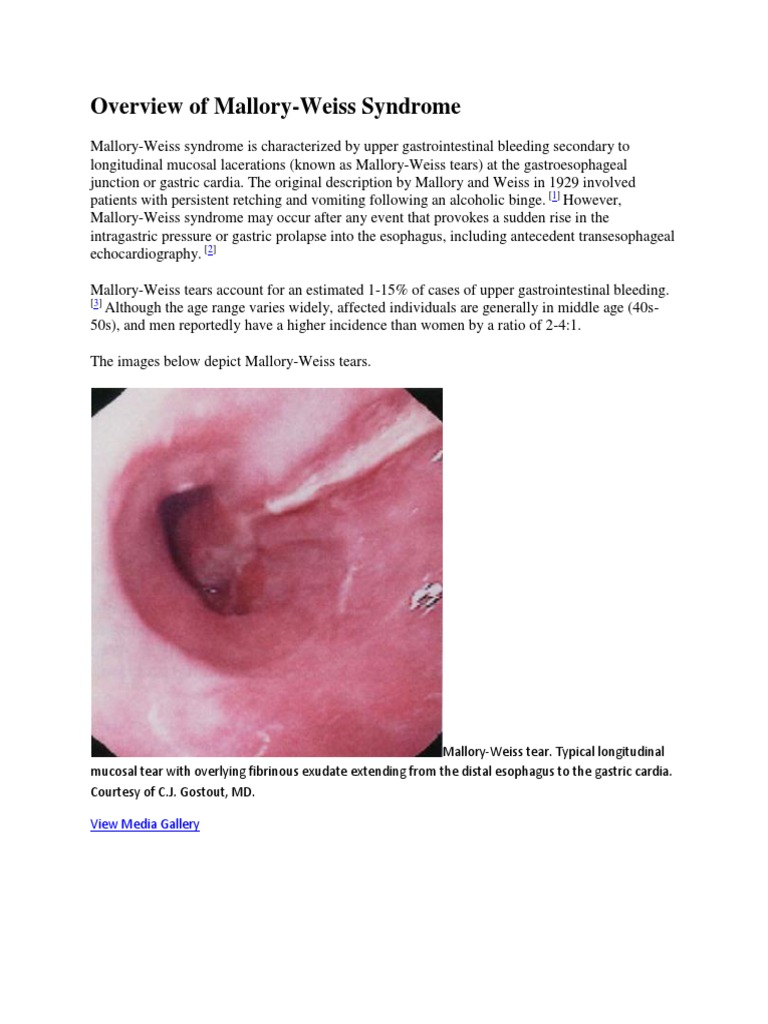 Overview of Mallory | PDF | Endoscopy | Bleeding