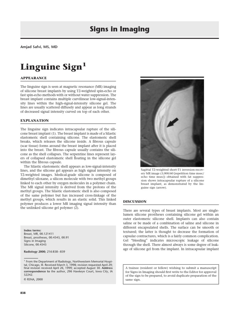 Linguine Sign PDF | Download Free PDF | Materials | Medical Specialties