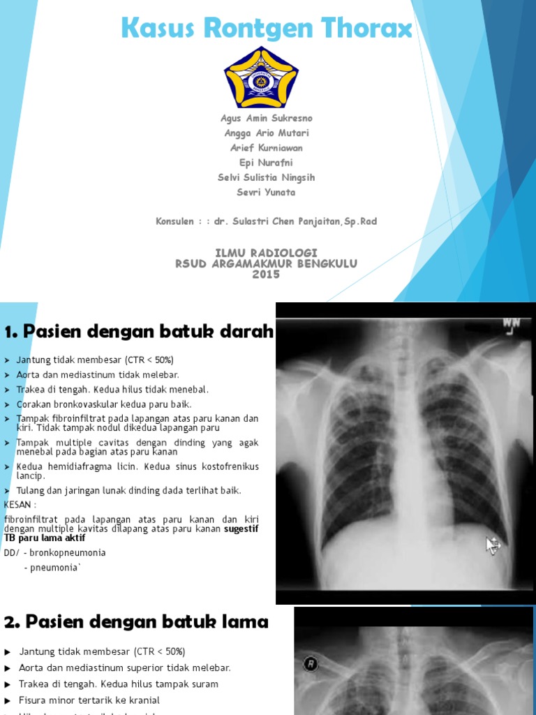 Kasus Rontgen Thorax | PDF