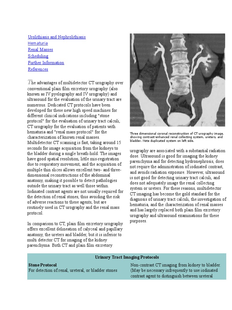 Urolithiasis and Nephrolithiasis | PDF | Ct Scan | Medical Imaging