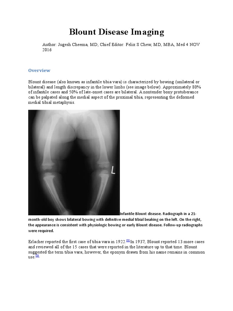 Blount Disease Imaging | Medical Imaging | Magnetic Resonance Imaging